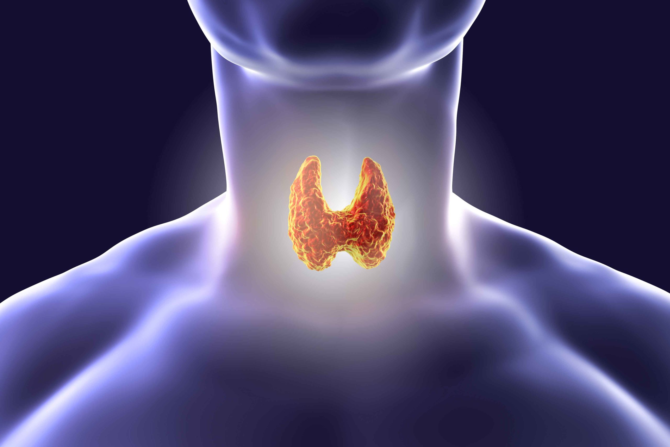 New guidelines validate push back on thyroid surgery: Patient story ...